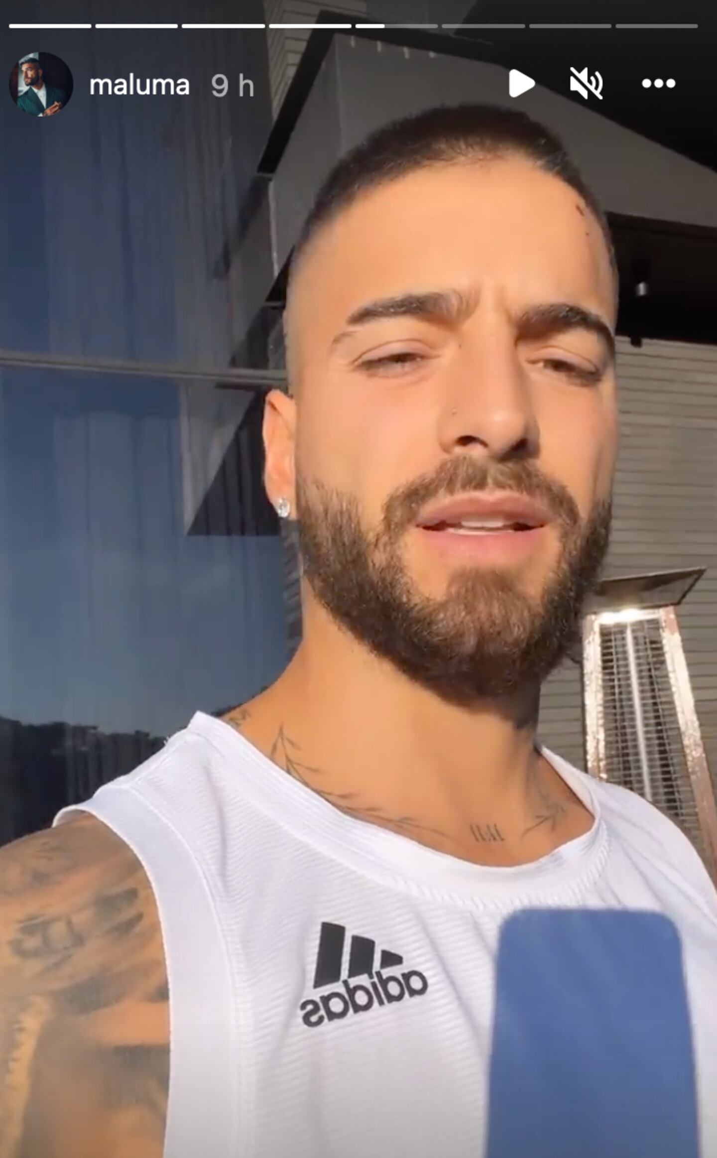 Maluma ha aparecido con heridas en su cara y ahora revela que fue lo ...