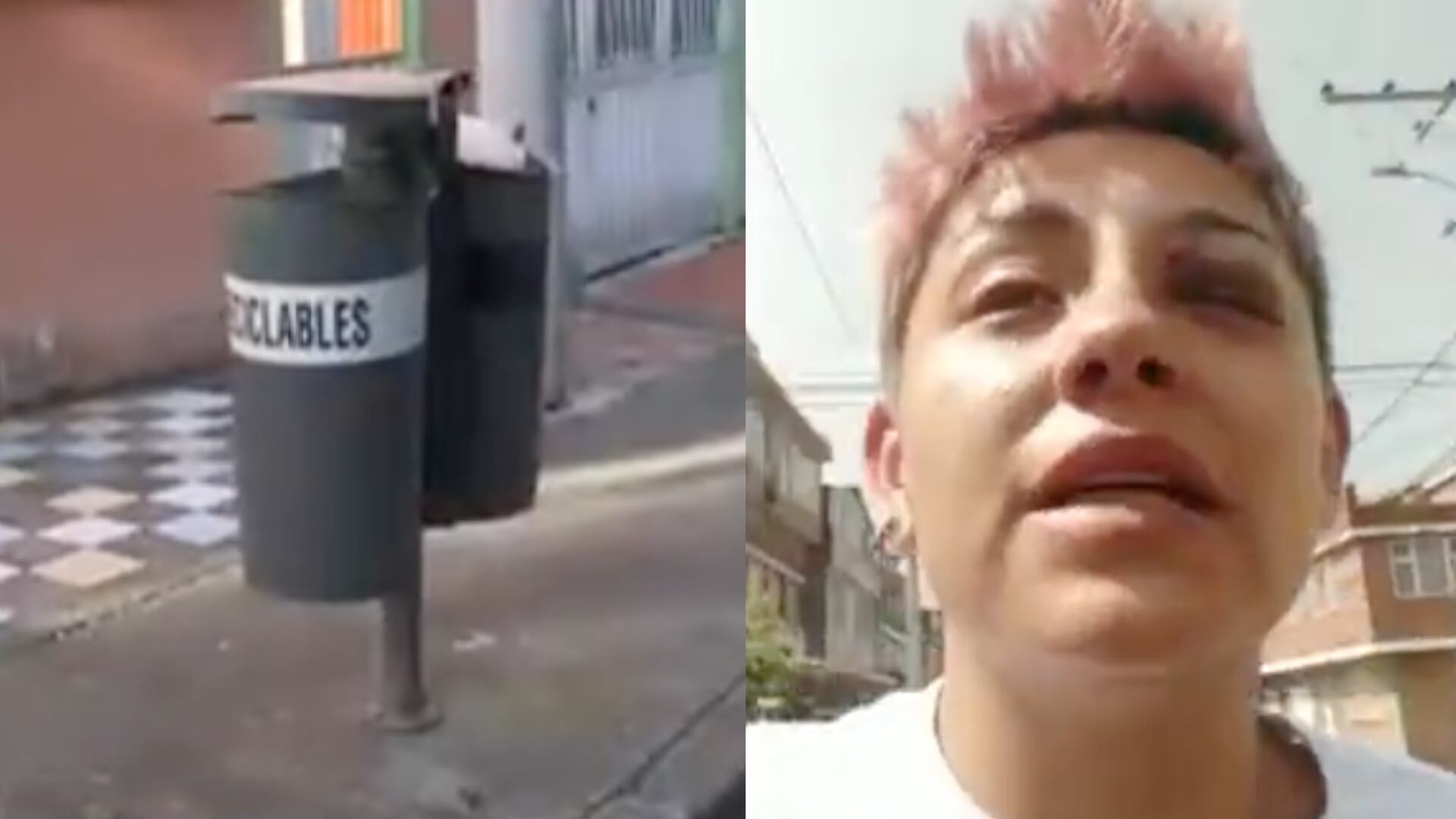 Mujer Fue Golpeada Por Su Vecino Por Pedirle Que Sacara La Basura En